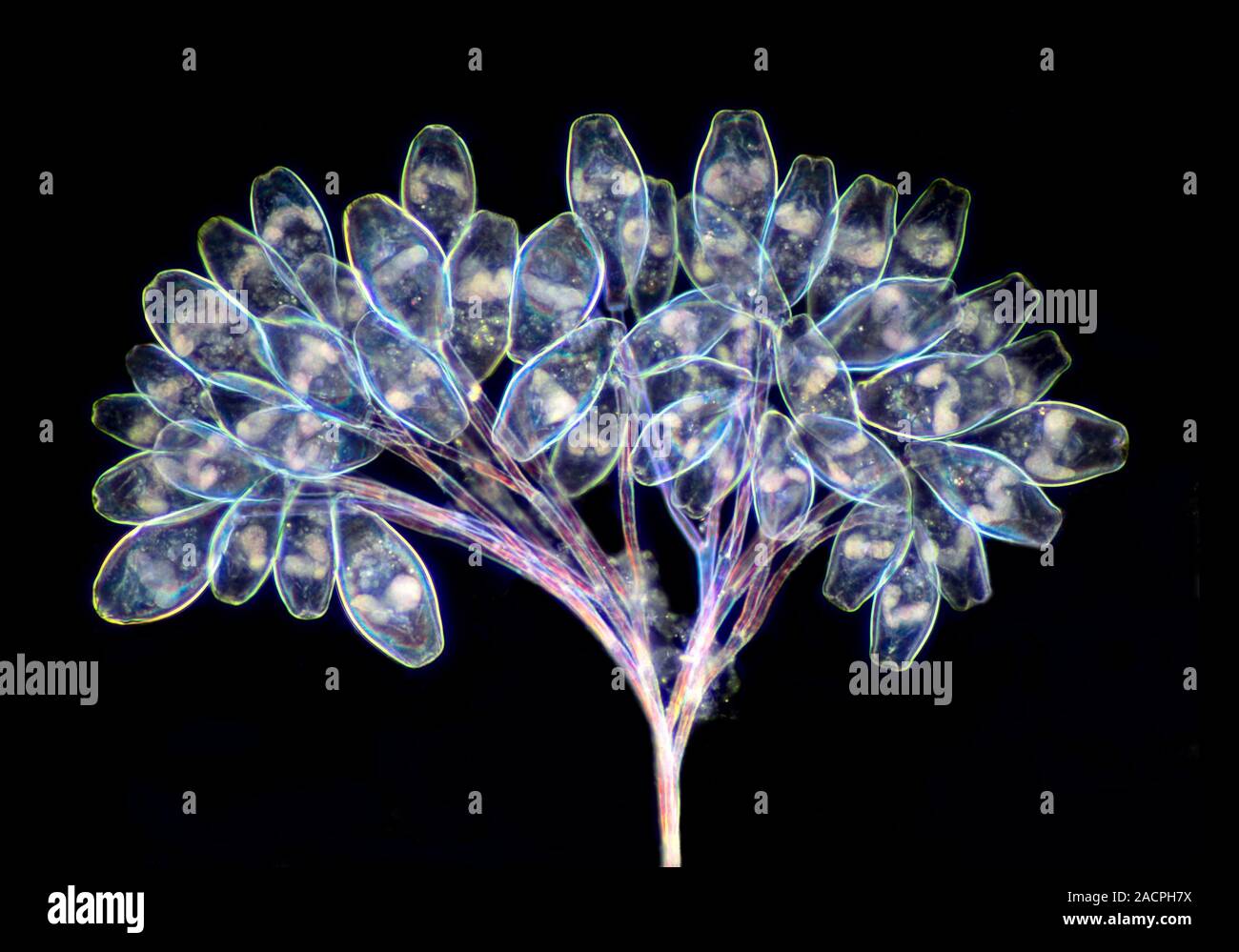 Vorticella Protozoen. Differential Interferenz Kontrast (DIC) leichte ...