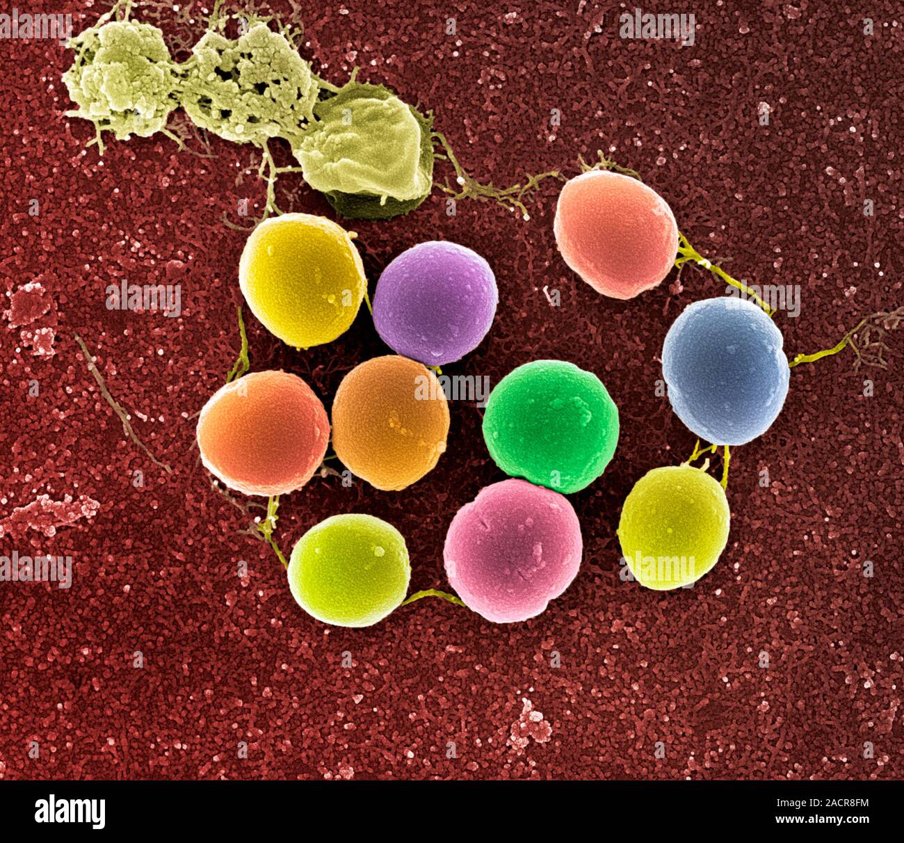 Staphylococcus aureus-Bakterien, Farbig Scanning Electron Micrograph ...