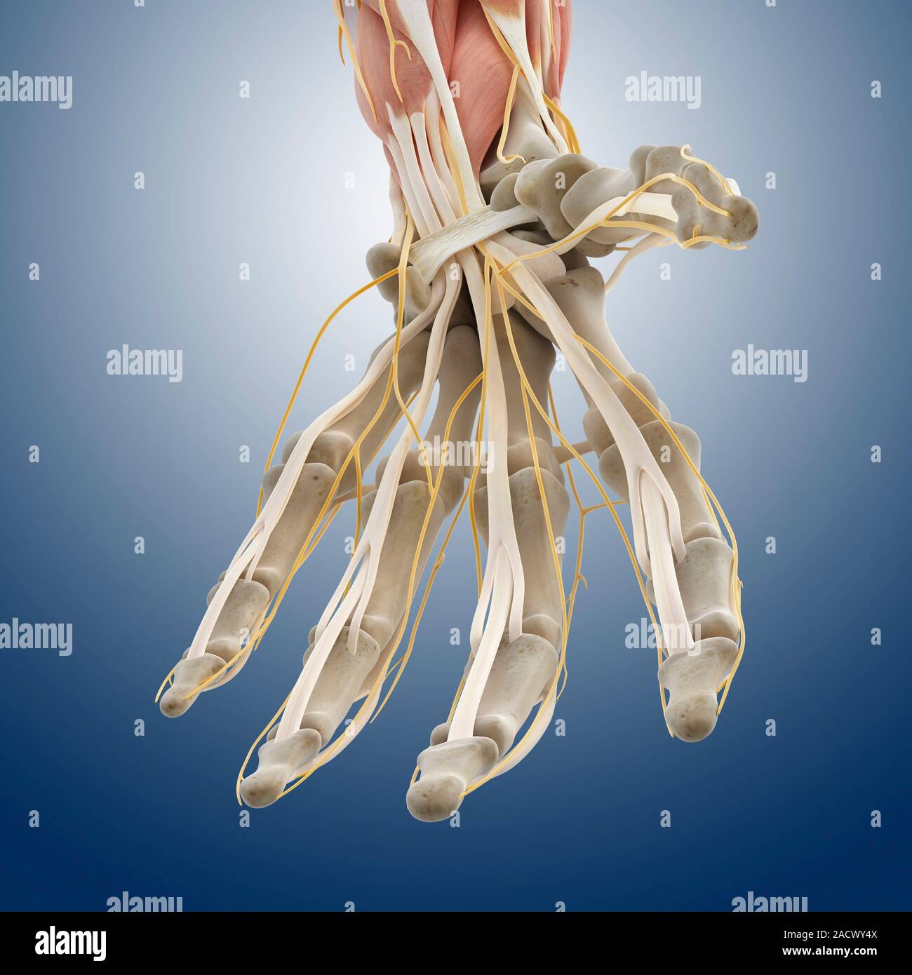 Das Karpaltunnelsyndrom, handgelenk Anatomie. Kunstwerk eines Palmar ...