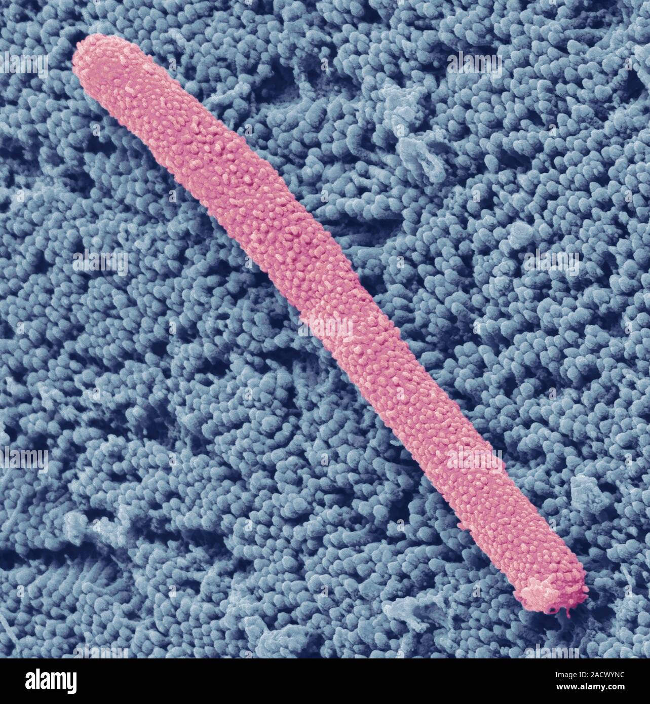 Bakterium in die menschliche Anlage, Farbig Scanning Electron ...