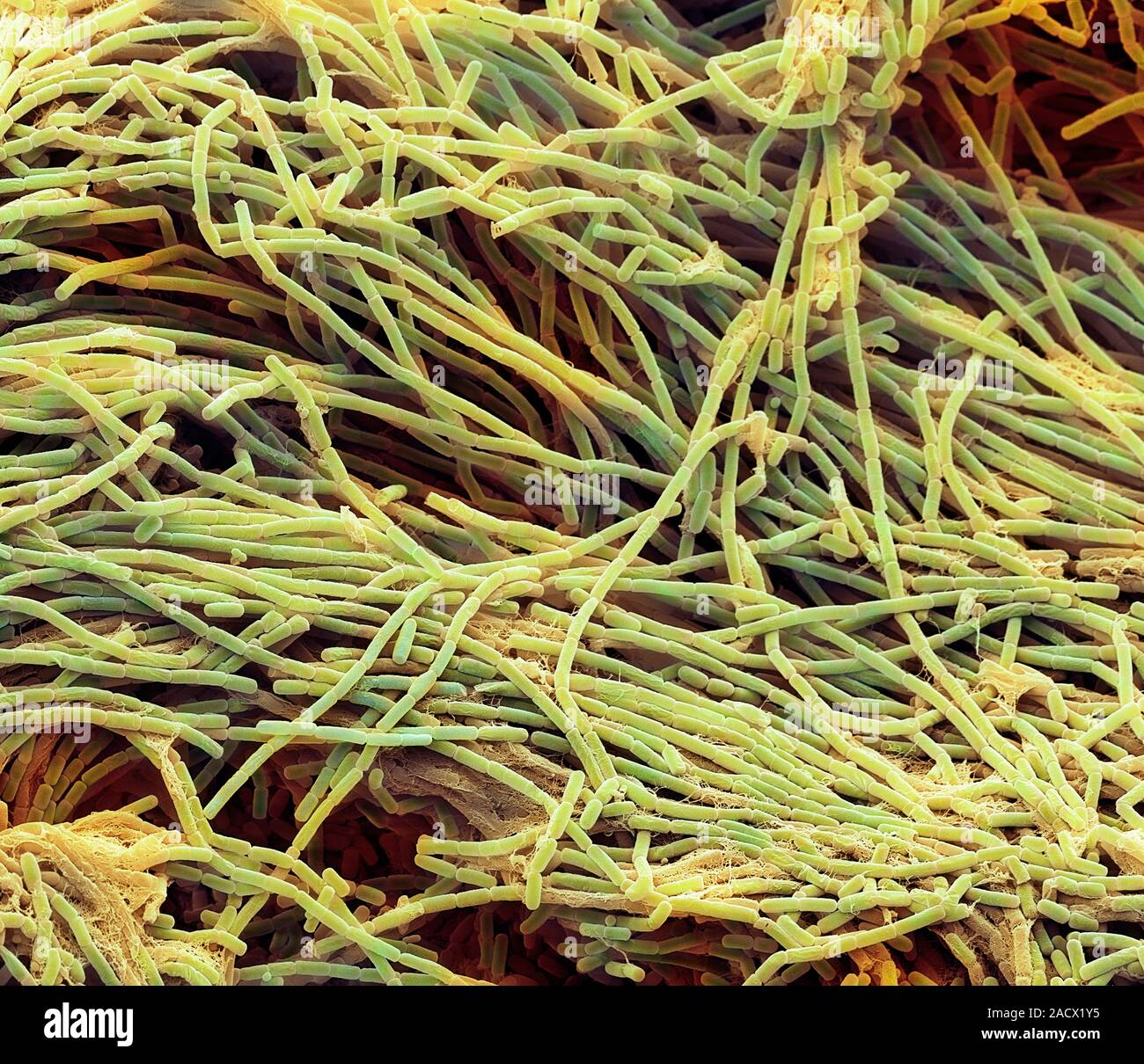Bacillus megaterium Bakterien, farbige Scanning Electron Micrograph ...