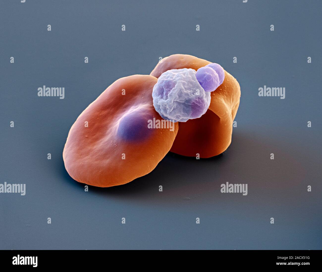Babesia Protozoen. Farbige Scanning Electron Micrograph (SEM) eines ...
