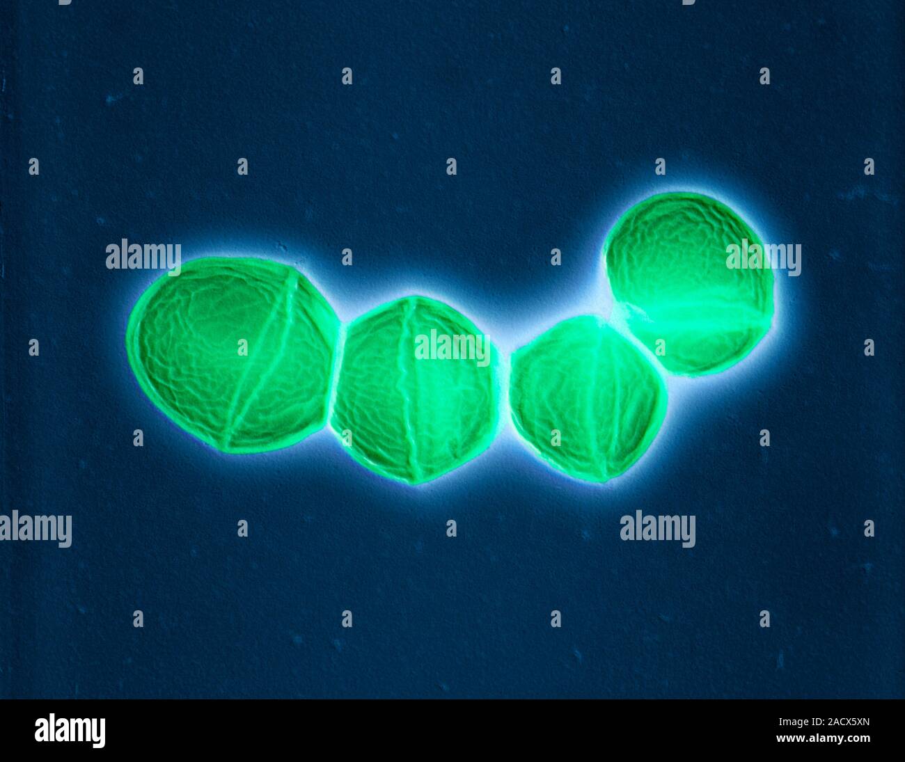 Streptococcus agalactiae Bakterien, farbige Scanning Electron ...