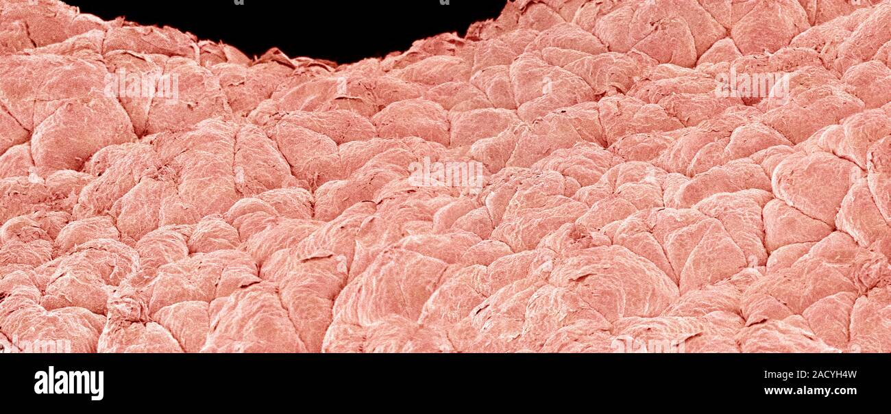 Die menschliche Haut. Farbige Scanning Electron Micrograph (SEM) der ...