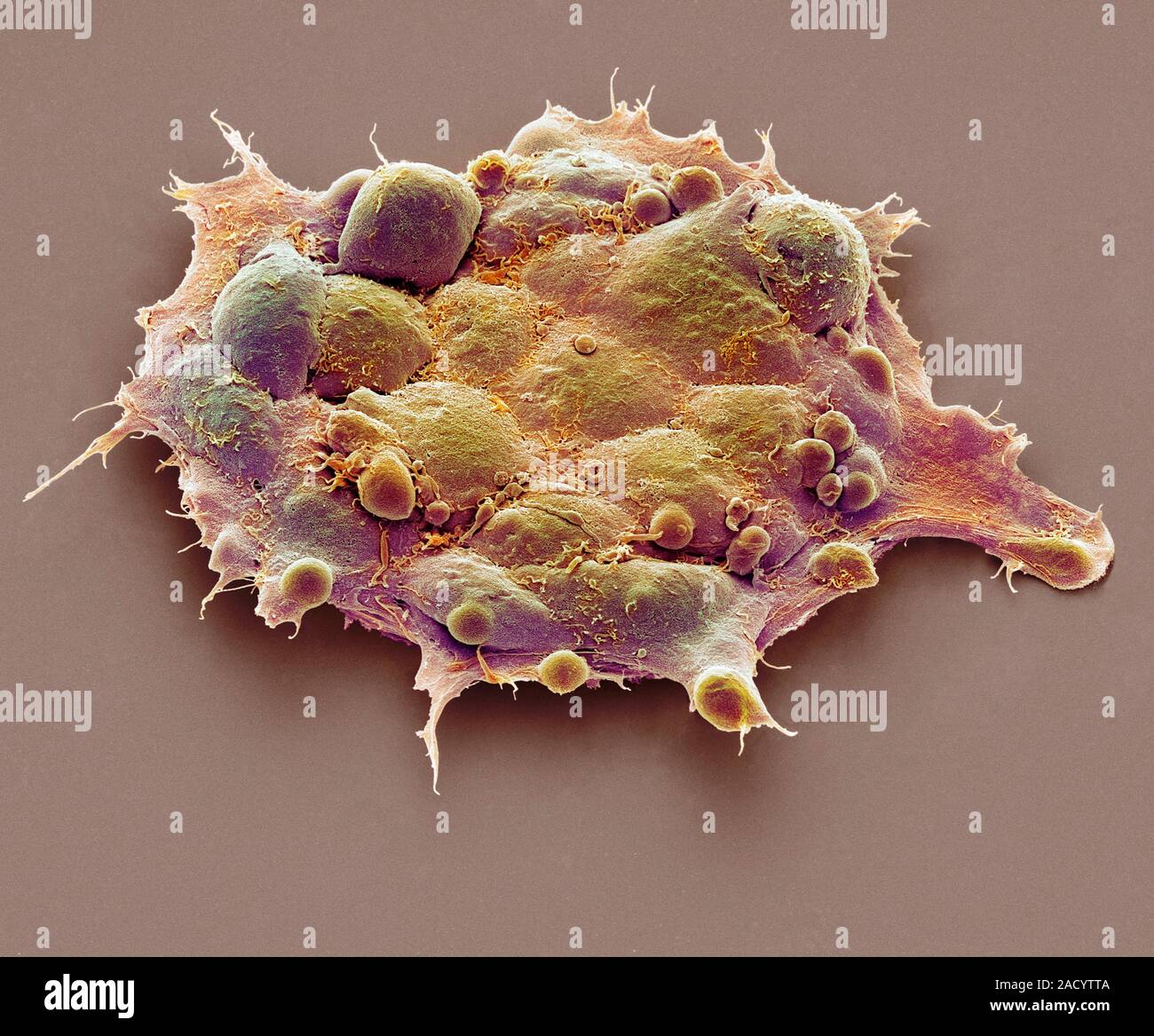 Pluripotente Stammzellen, Farbig Scanning Electron Micrograph (SEM) von ...