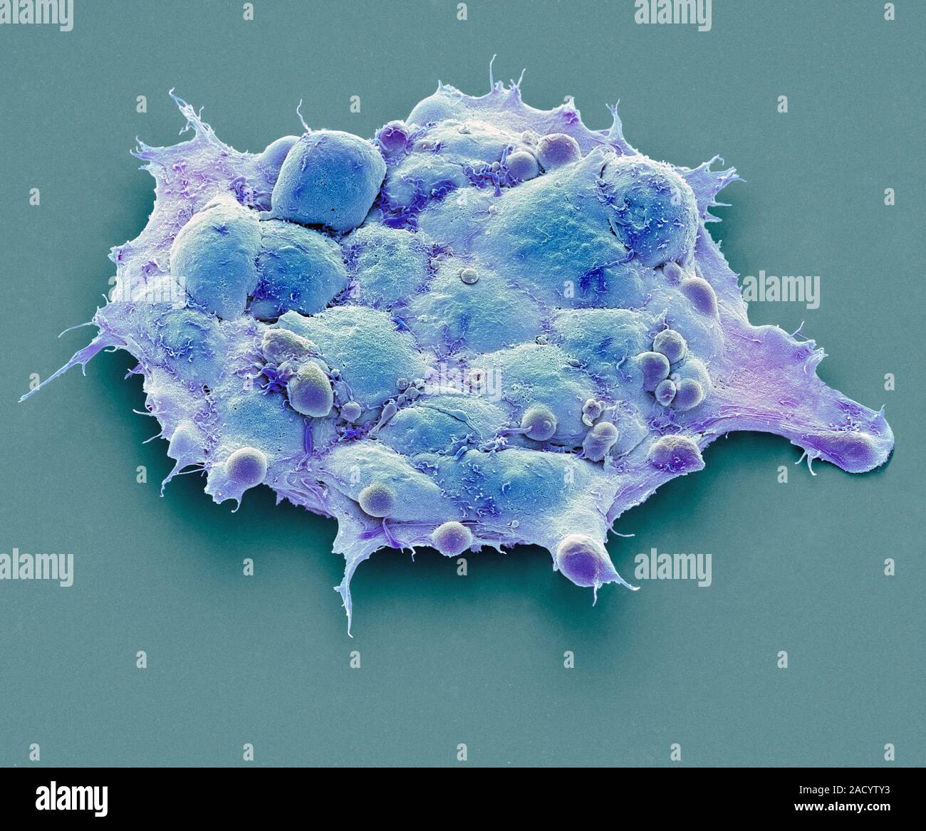 Pluripotente Stammzellen, Farbig Scanning Electron Micrograph (SEM) von ...