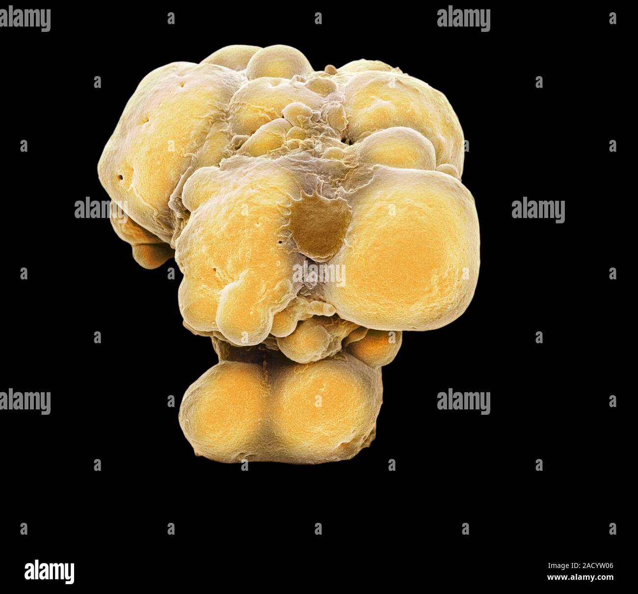 Pluripotente Stammzellen, Farbig Scanning Electron Micrograph (SEM) von ...