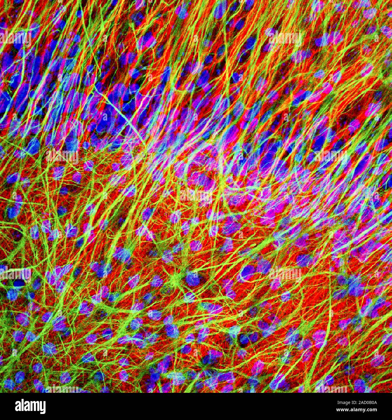 Zellen des Gehirns. Fluoreszenz Licht Aufnahme eines Abschnitts durch ...
