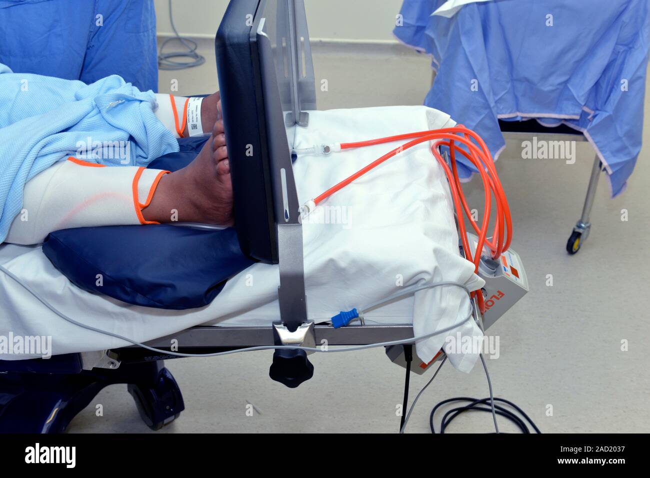 Intermittierende pneumatische Kompression (IPK) Hülsen auf die Beine ...