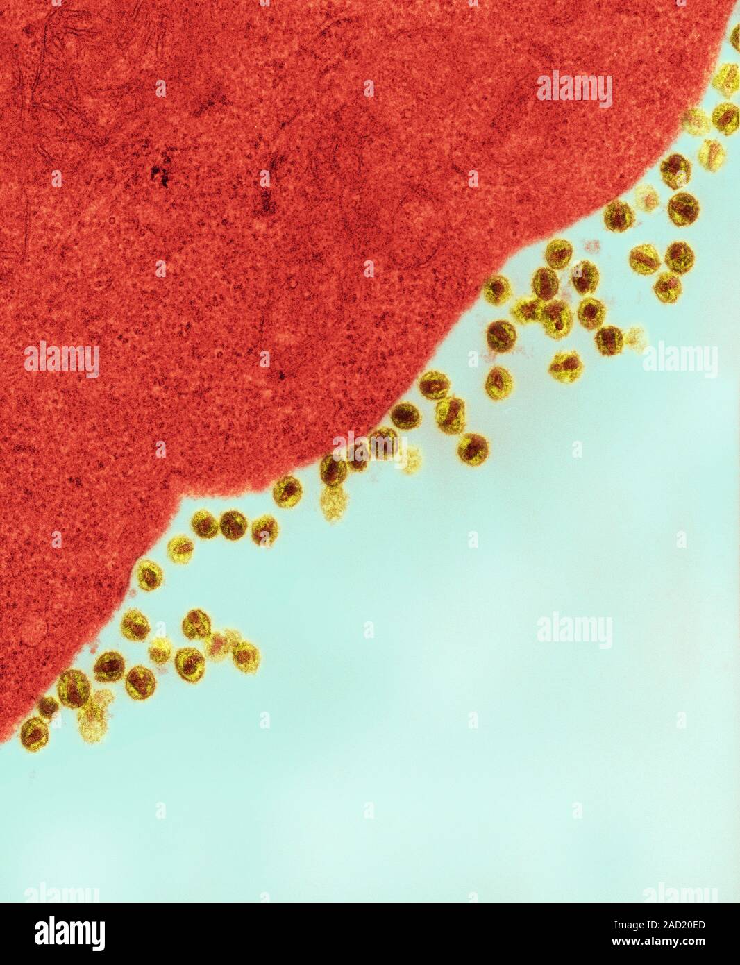 HIV-Viren infizieren einer Zelle. Transmission Electron Micrograph (TEM ...