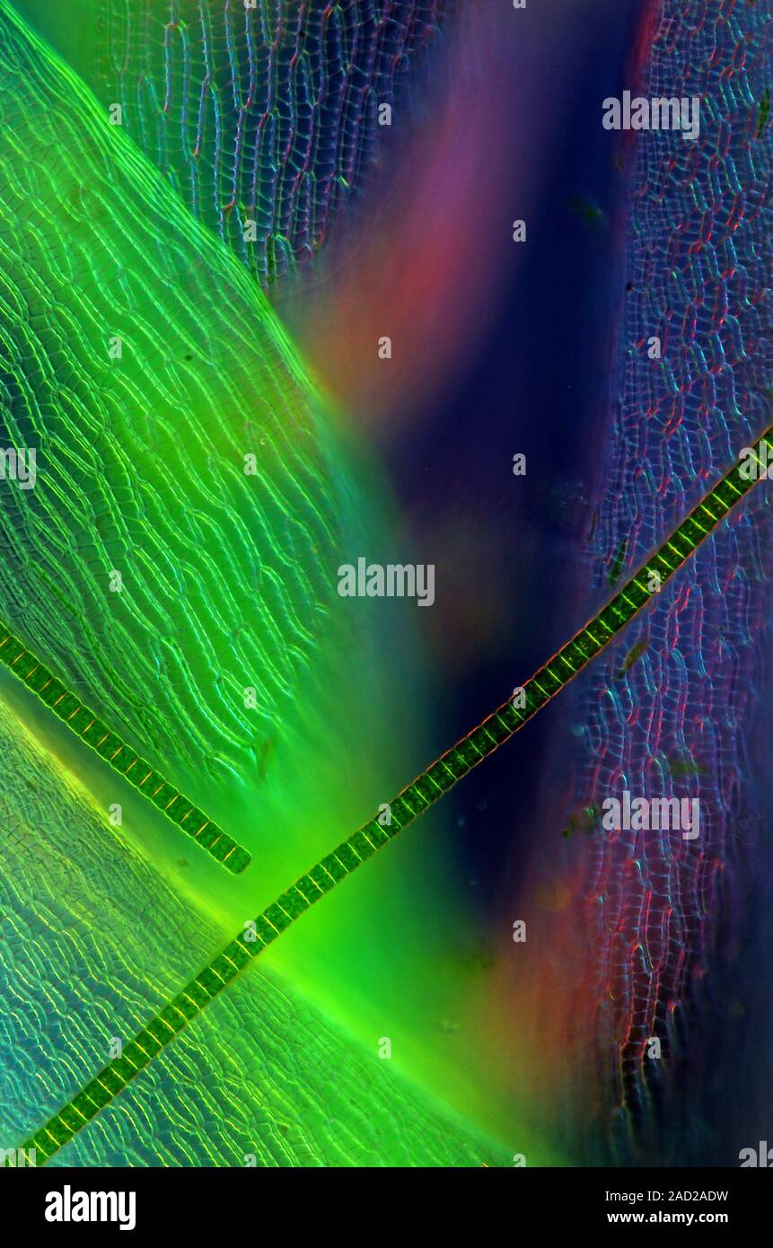Auf Desmids sphagnum Moos. Darkfield beleuchtete polarisiertes Licht ...