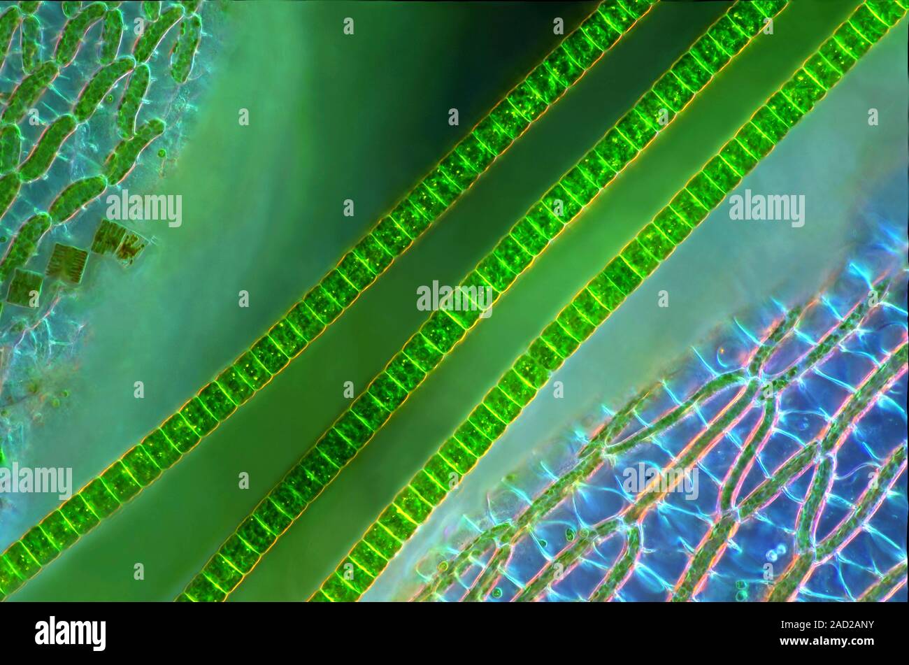 Auf Desmids sphagnum Moos. Darkfield beleuchtete polarisiertes Licht ...