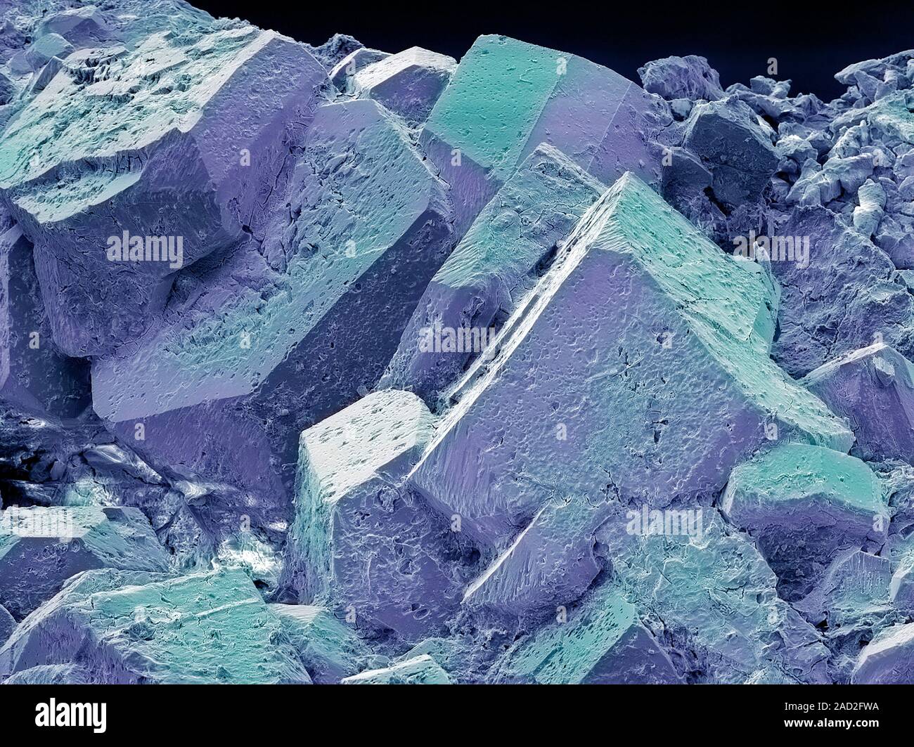 Enterolith. Farbige Scanning Electron Micrograph (SEM, Bilderfassung ...