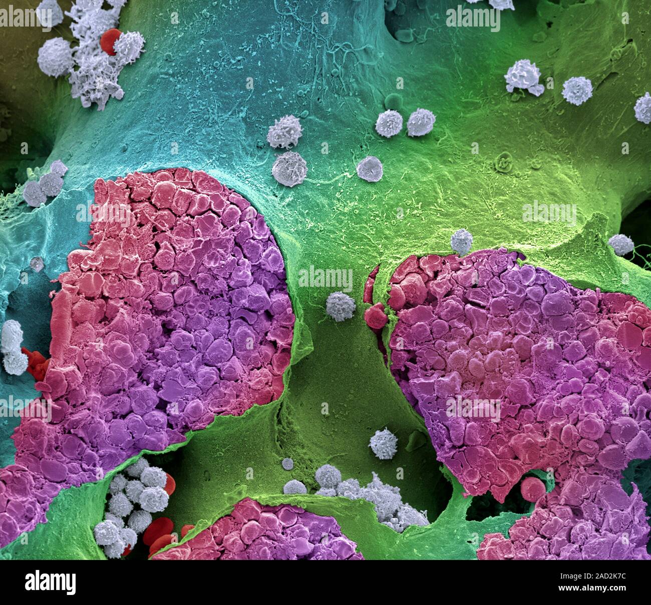 Knochenmark. Farbige Scanning Electron Micrograph (SEM) von Knochenmark ...