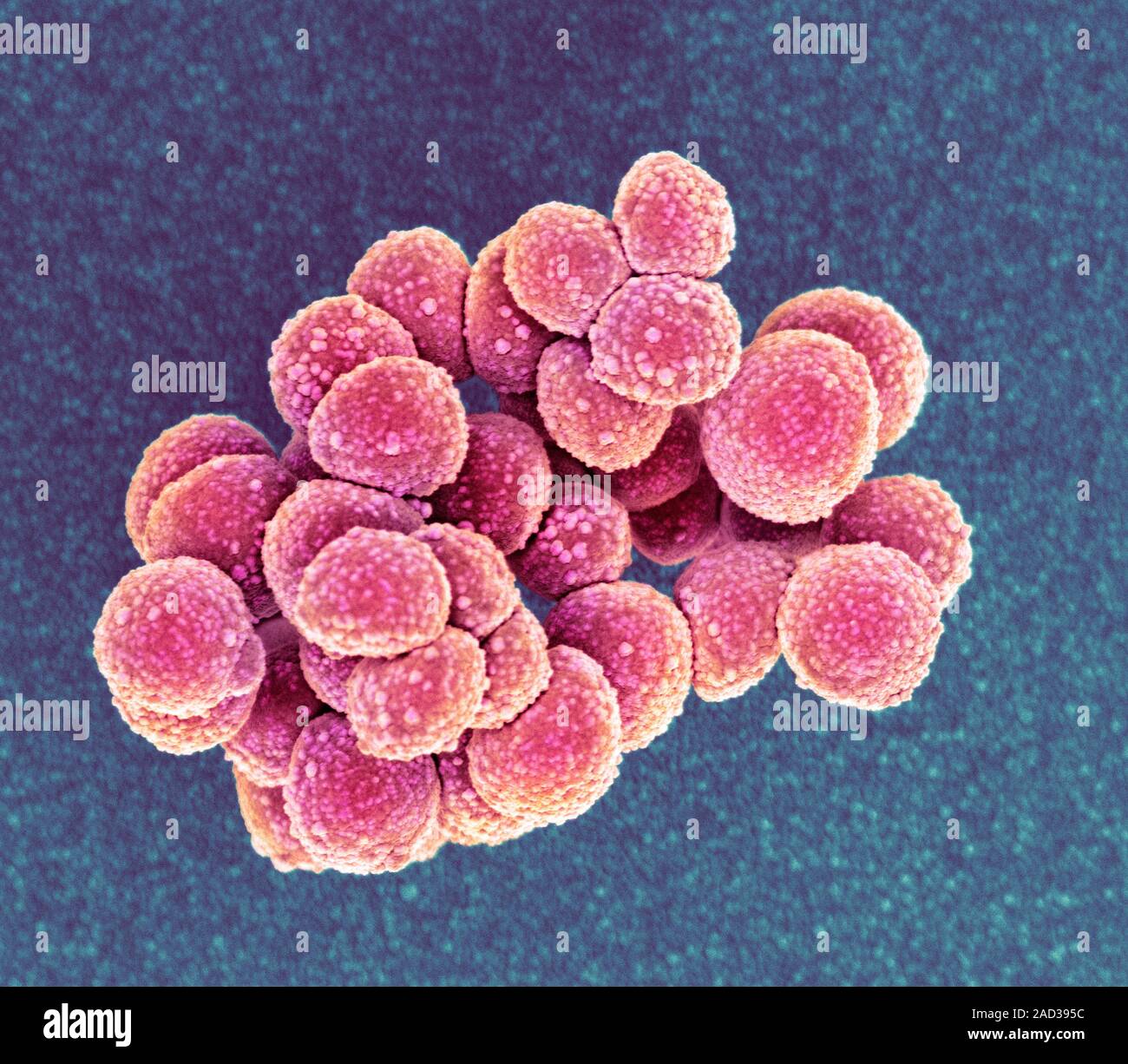 MRSA-Bakterien. Farbige Scanning Electron Micrograph (SEM) Methicillin ...