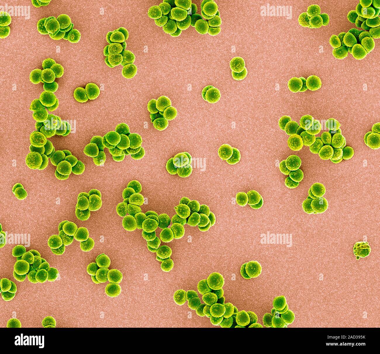 MRSA-Bakterien. Farbige Scanning Electron Micrograph (SEM) Methicillin ...