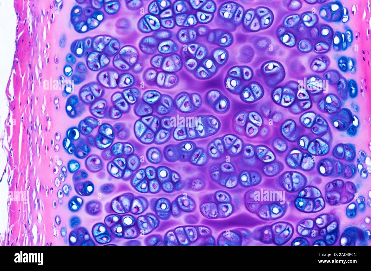 Licht Mikroskopie von hyalinem Knorpel aus chondrozyten (blau) in die ...