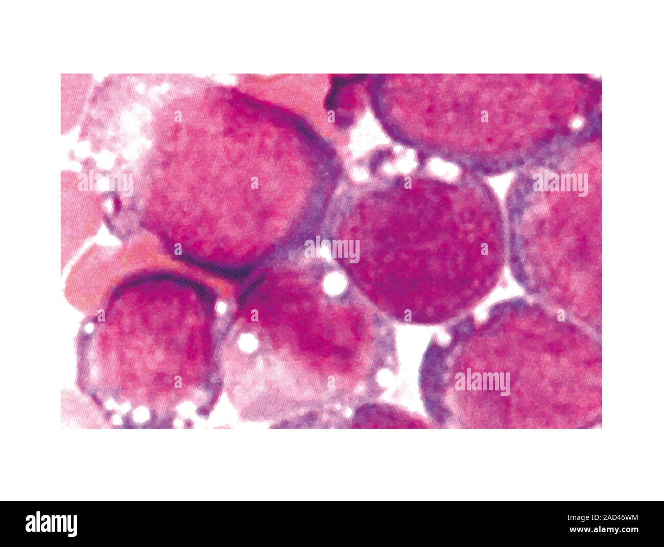 Thrombozyt weißen Blutkörperchen. Diese Abbildung ist von Asklepios ...