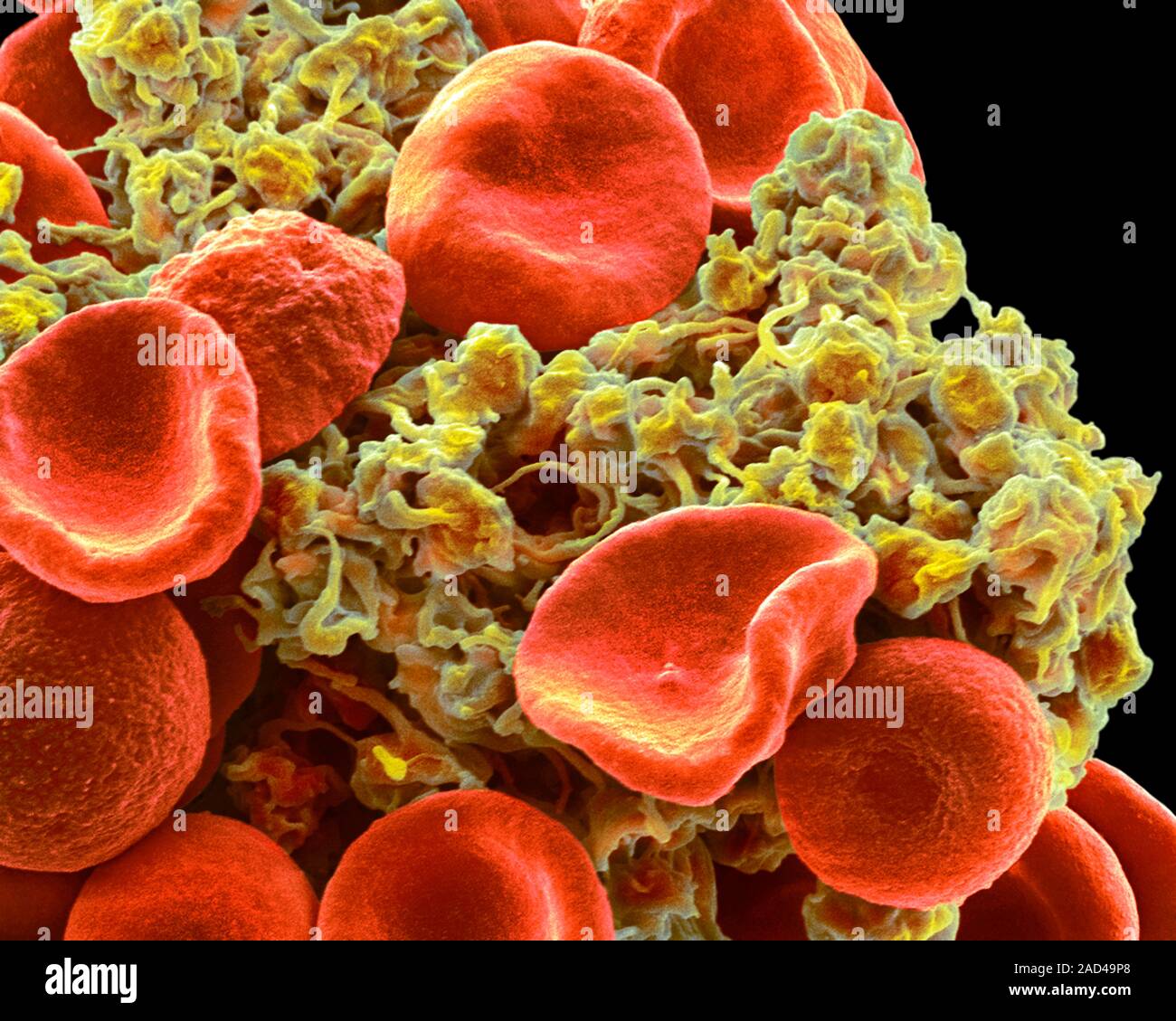 Rote Blutkörperchen und Blutplättchen. Farbiges scannen electon ...