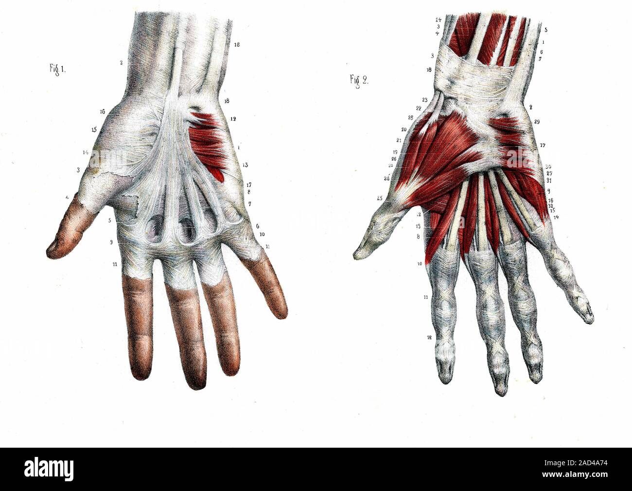 Die menschliche Hand. 1866 anatomische Abbildung: die Muskeln und ...