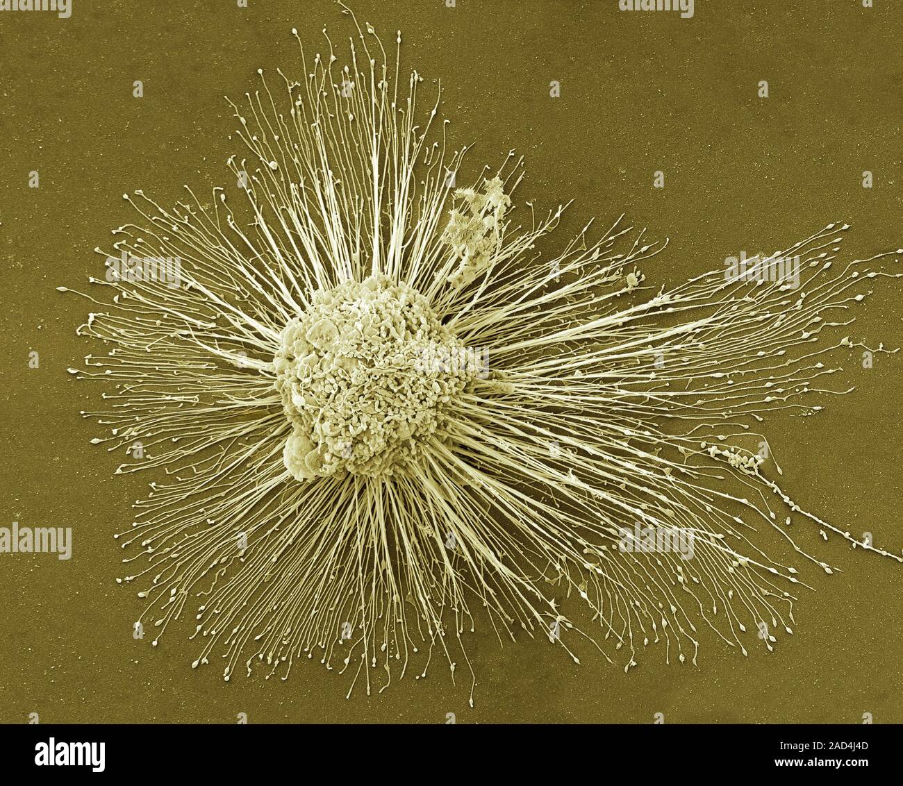 Induzierte pluripotente Stammzellen. Farbige Scanning Electron ...