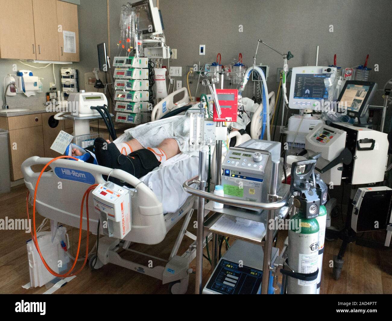Life Support auf der Intensivstation. Patient auf die extrakorporale Membranoxygenation (ECMO ...
