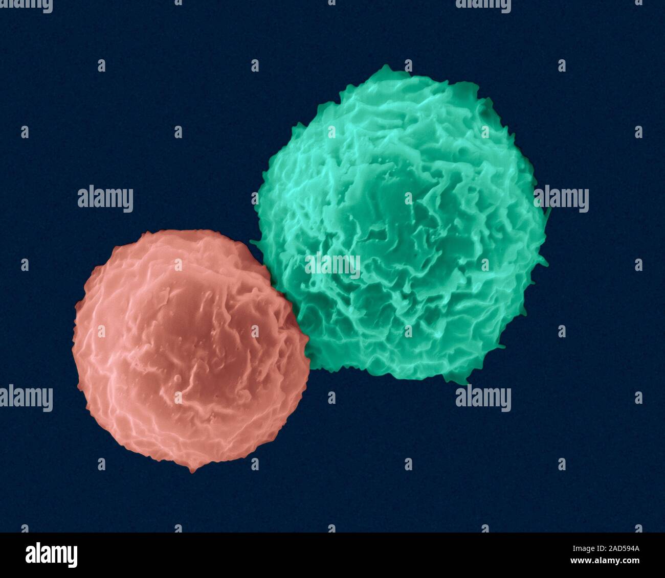 Helfer-T-Zellen (kleine Zellen) und B-Zellen (große Zellen), farbige ...