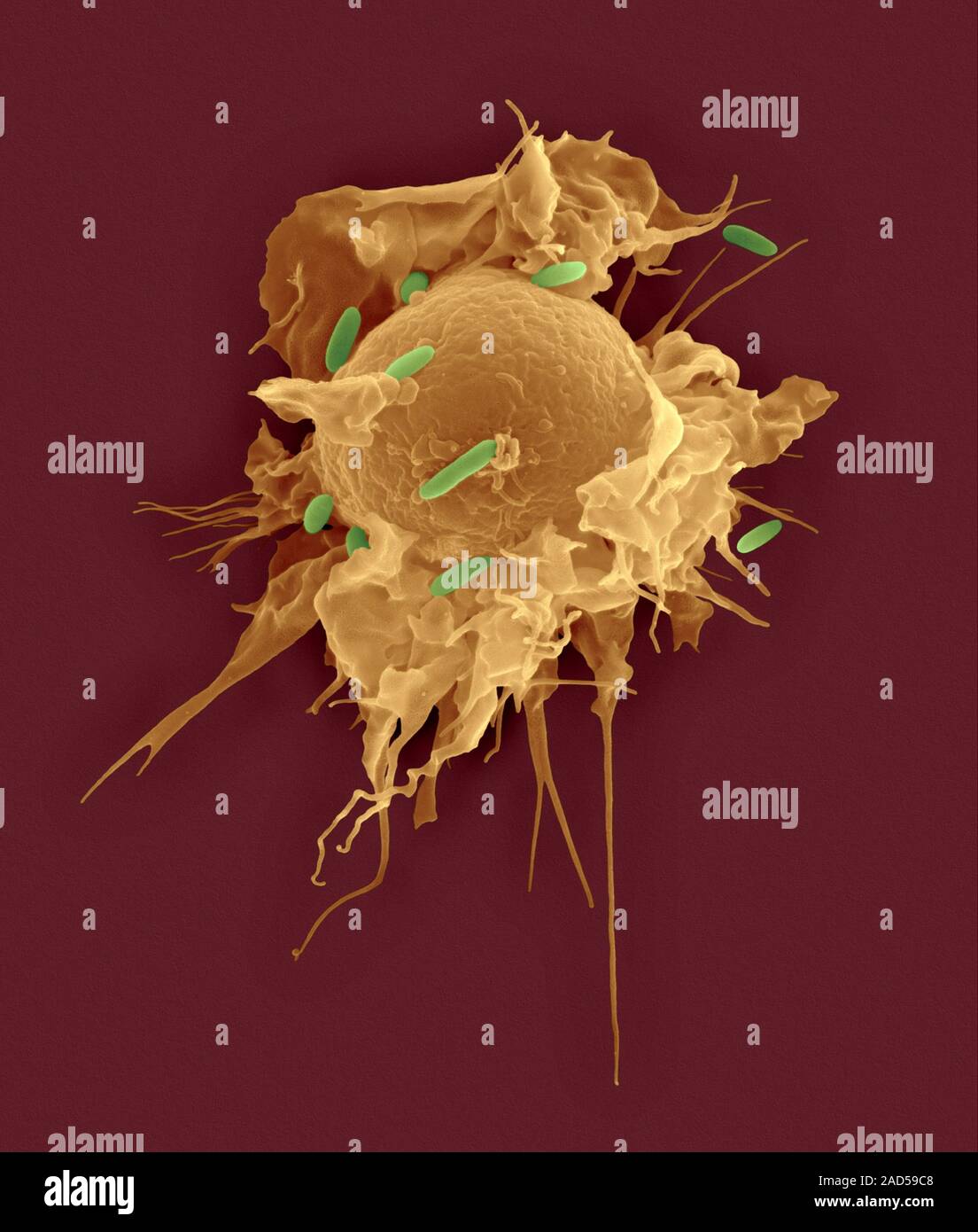 Alveoläre Gewebe makrophage Phagozytose von E. coli, Farbig Scanning ...