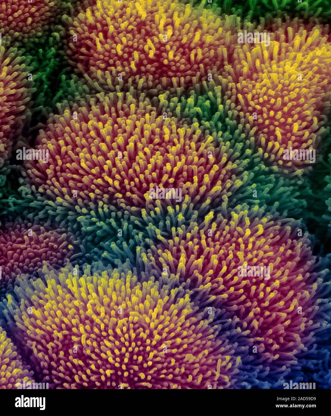 Nasen-rachen-Oberfläche, Farbig Scanning Electron Micrograph (SEM ...