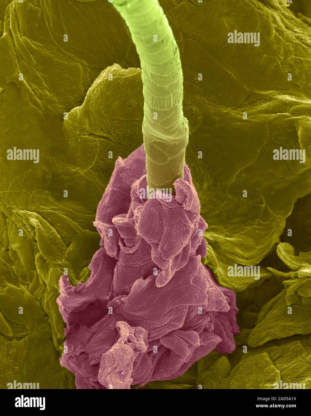 Die menschliche Haut (Epidermis) mit Haaren aus Haarfollikel, Farbig ... Die menschliche Haut (Epidermis) mit Haaren aus Haarfollikel, Farbig ...