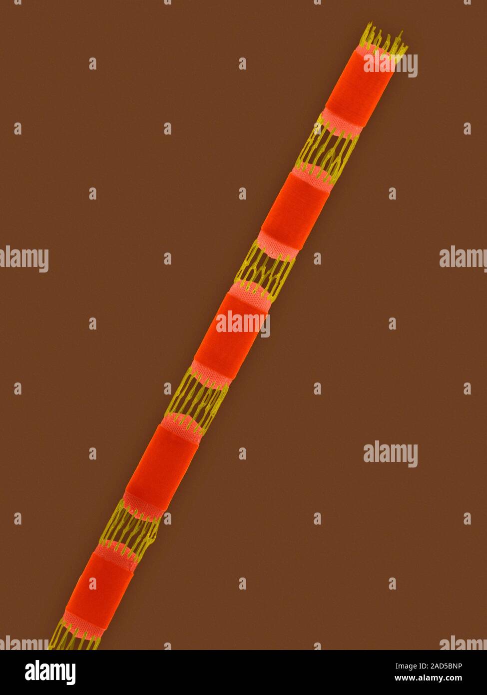 Farbige Scanning Electron Micrograph (SEM) der Marine, faserigen ...