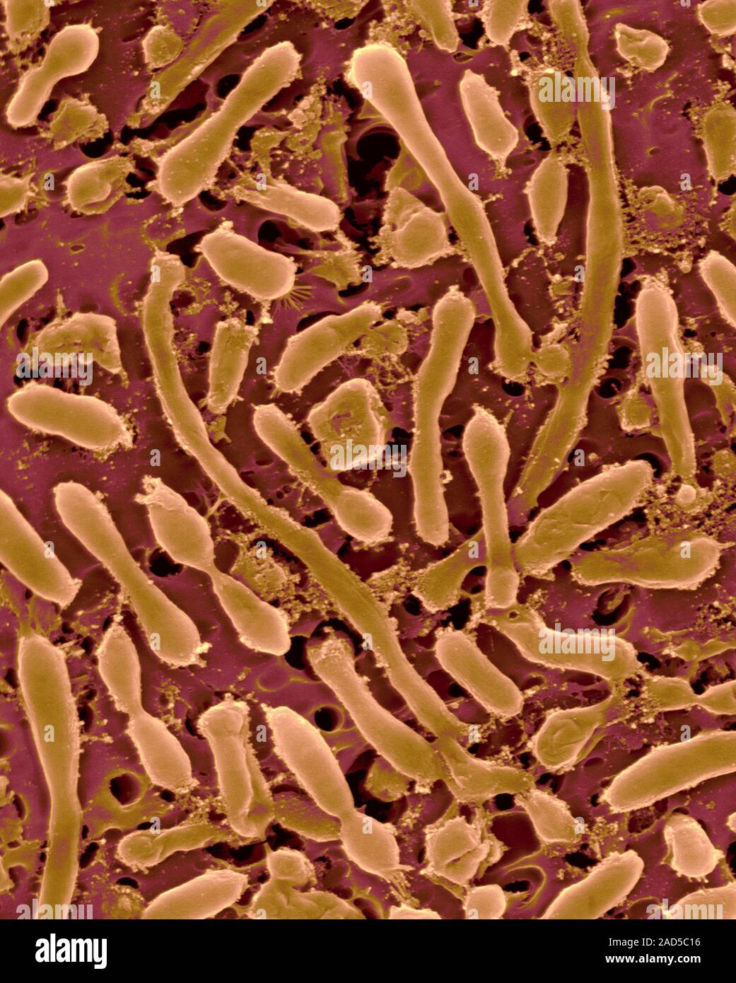 Farbige Scanning Electron Micrograph (SEM) von halophilen Archaeen ...