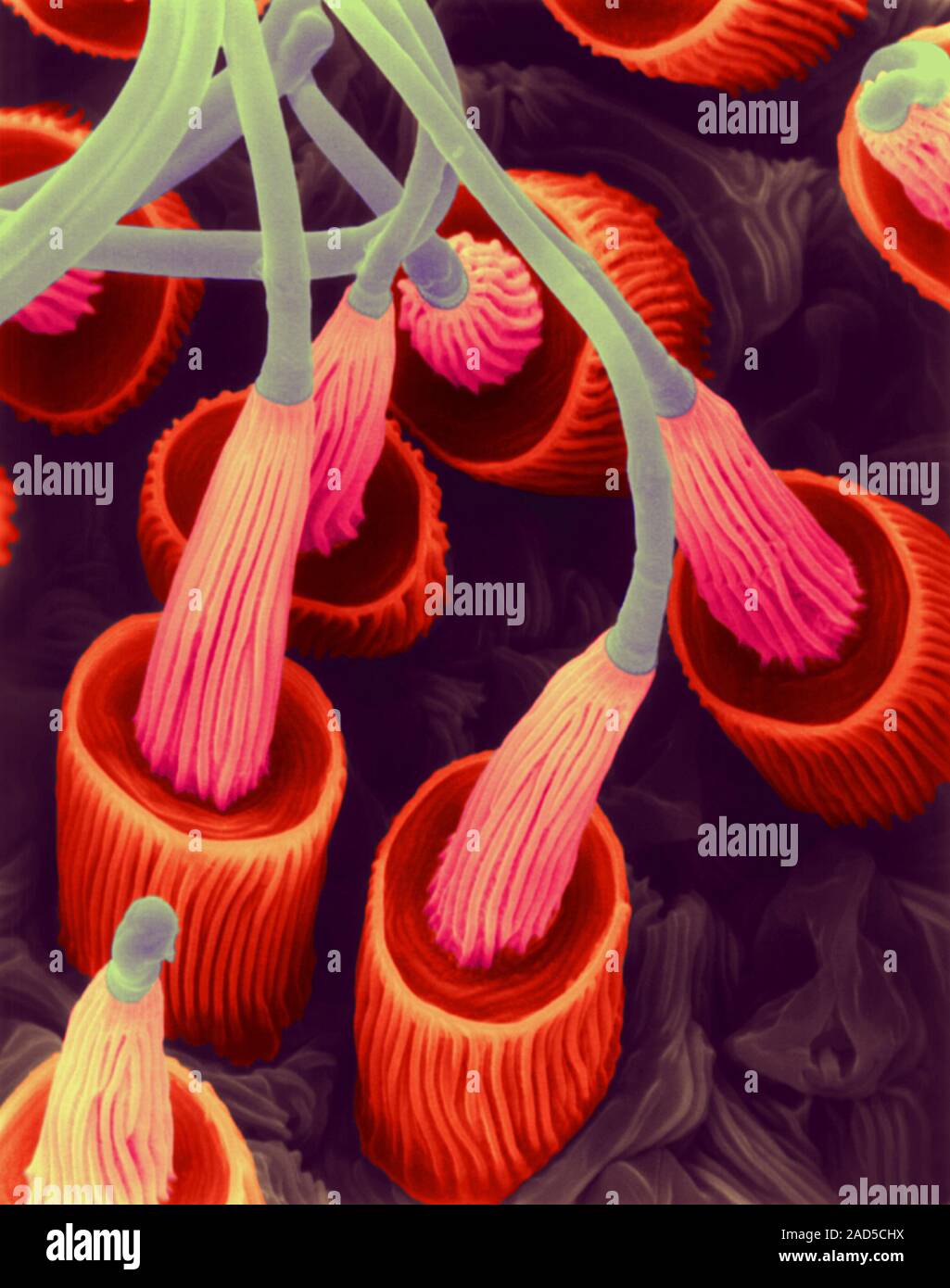 Farbige Scanning Electron Micrograph (SEM) der Stacheligen - gesichert ...