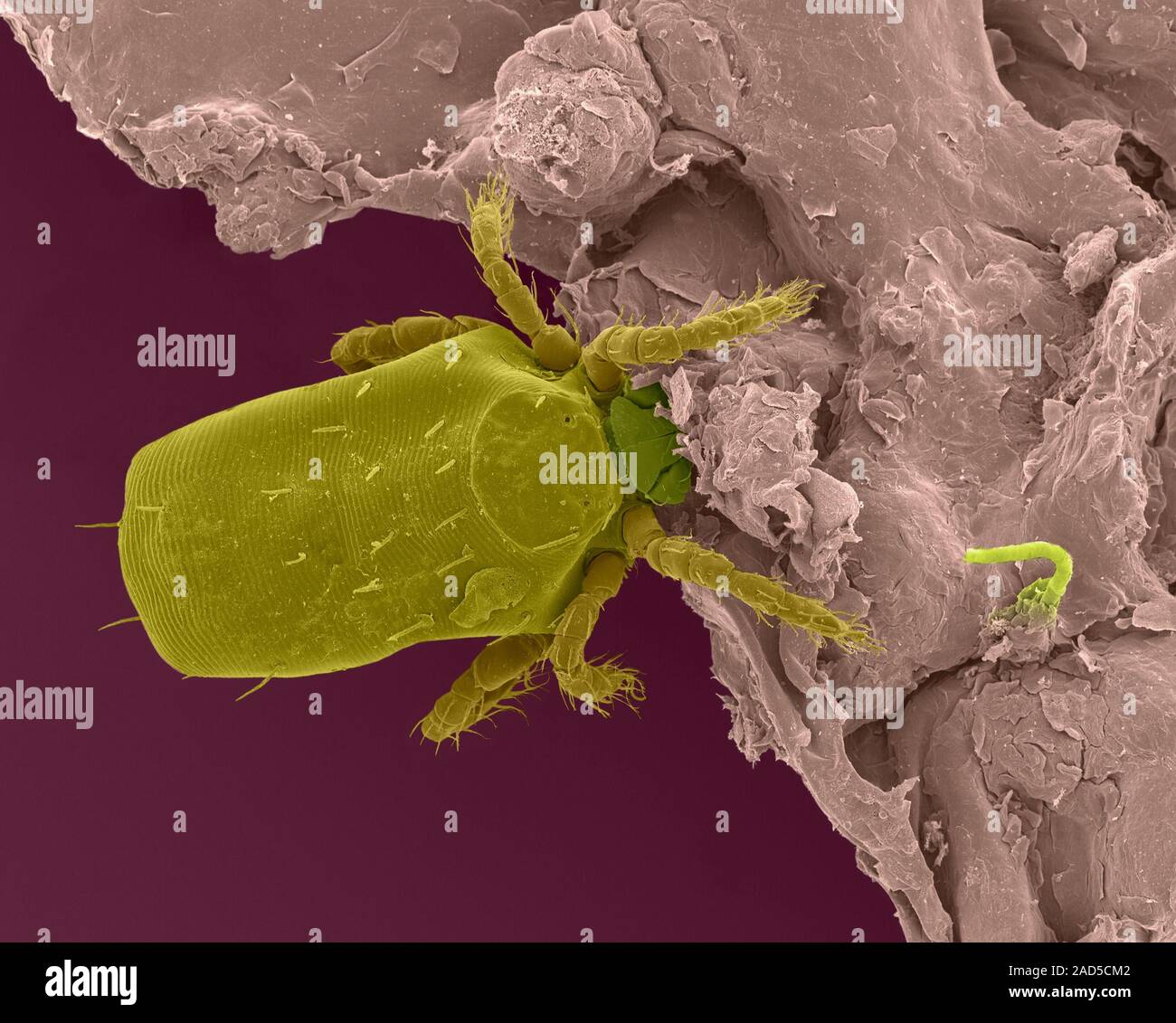 Farbige Scanning Electron Micrograph (SEM) der Chigger, Ernte milbe ...