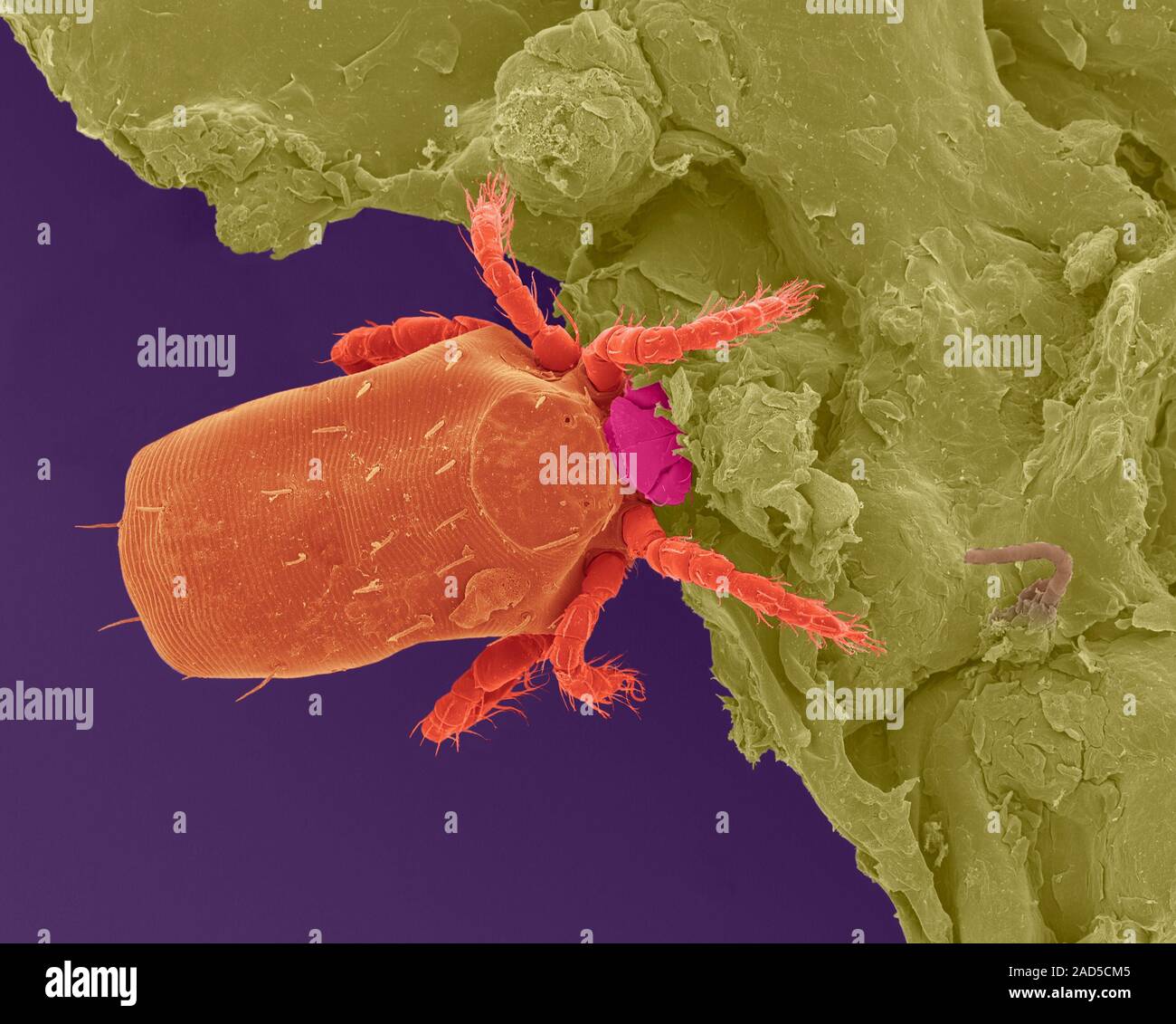 Farbige Scanning Electron Micrograph (SEM) der Chigger, Ernte milbe ...