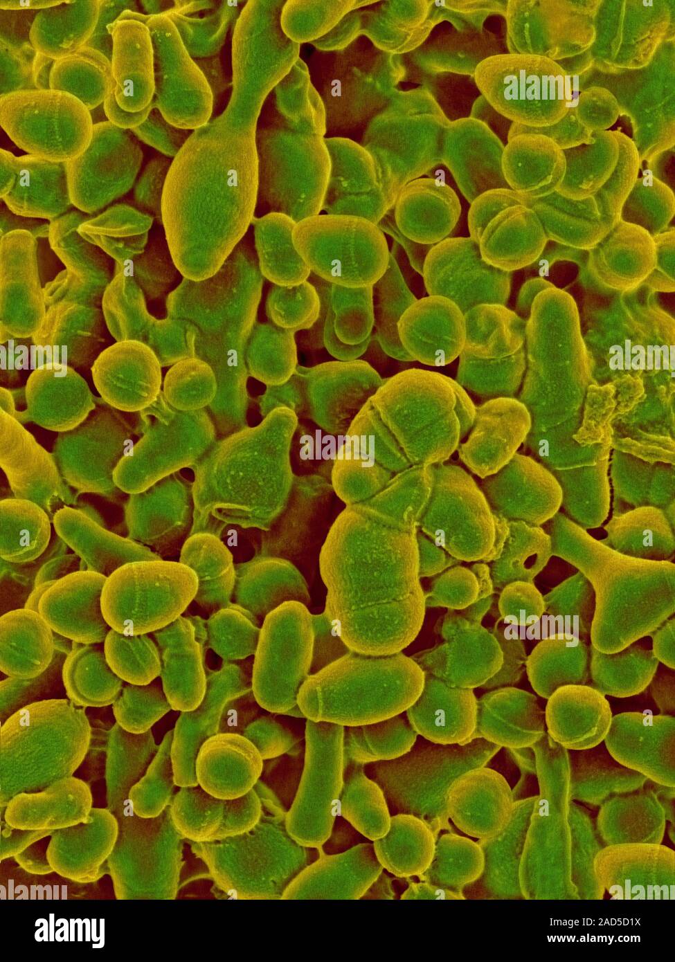 Farbige Scanning Electron Micrograph (SEM) der Microbacterium ...