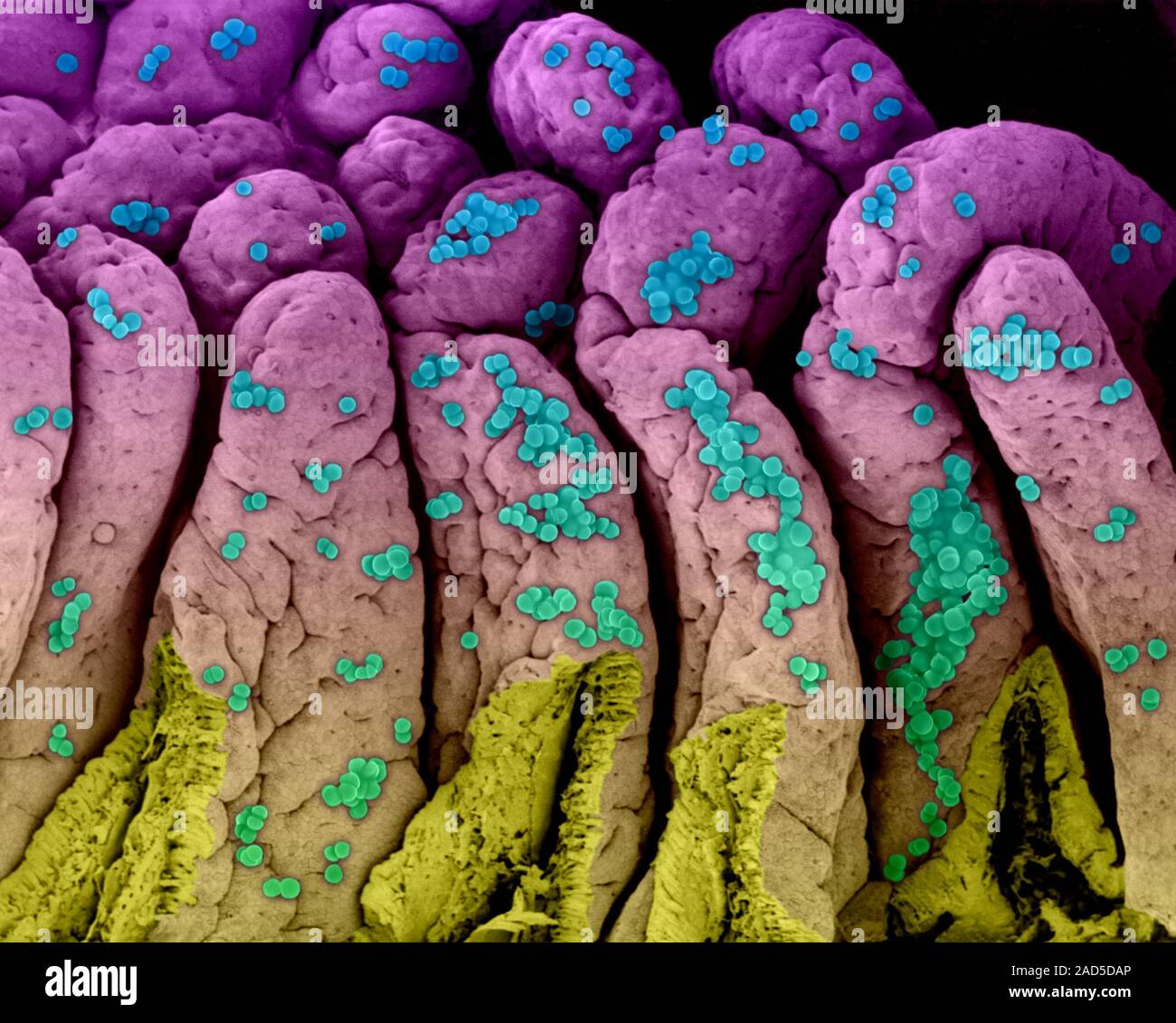 Farbige Scanning Electron Micrograph (SEM) der Photocomposite ...