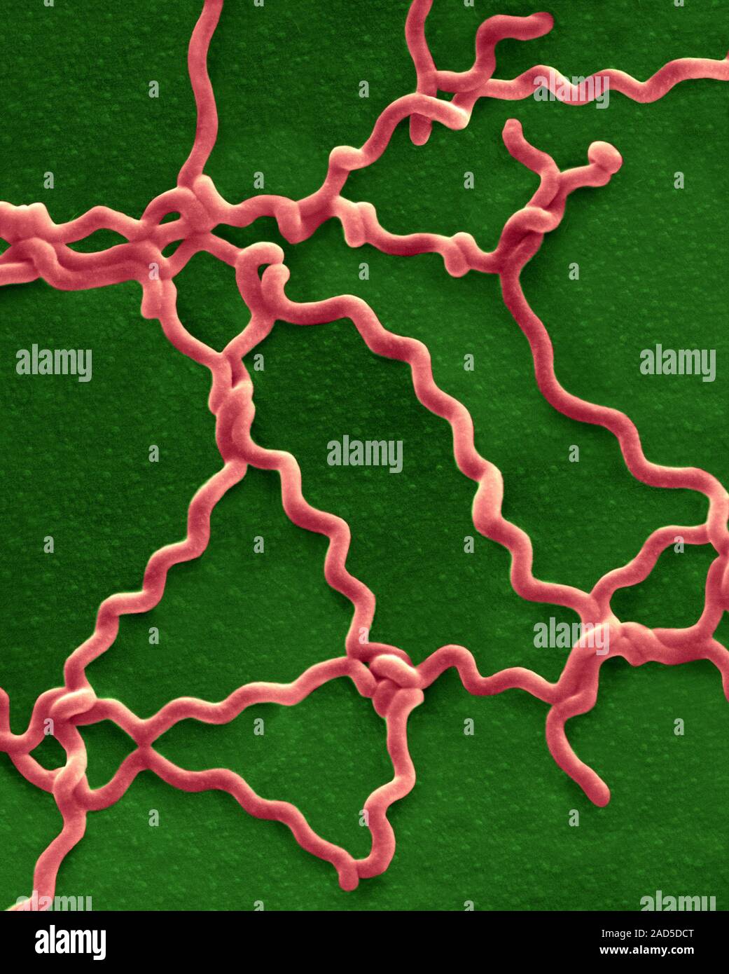 Farbige Scanning Electron Micrograph (SEM) von Leptospira interrogans ...