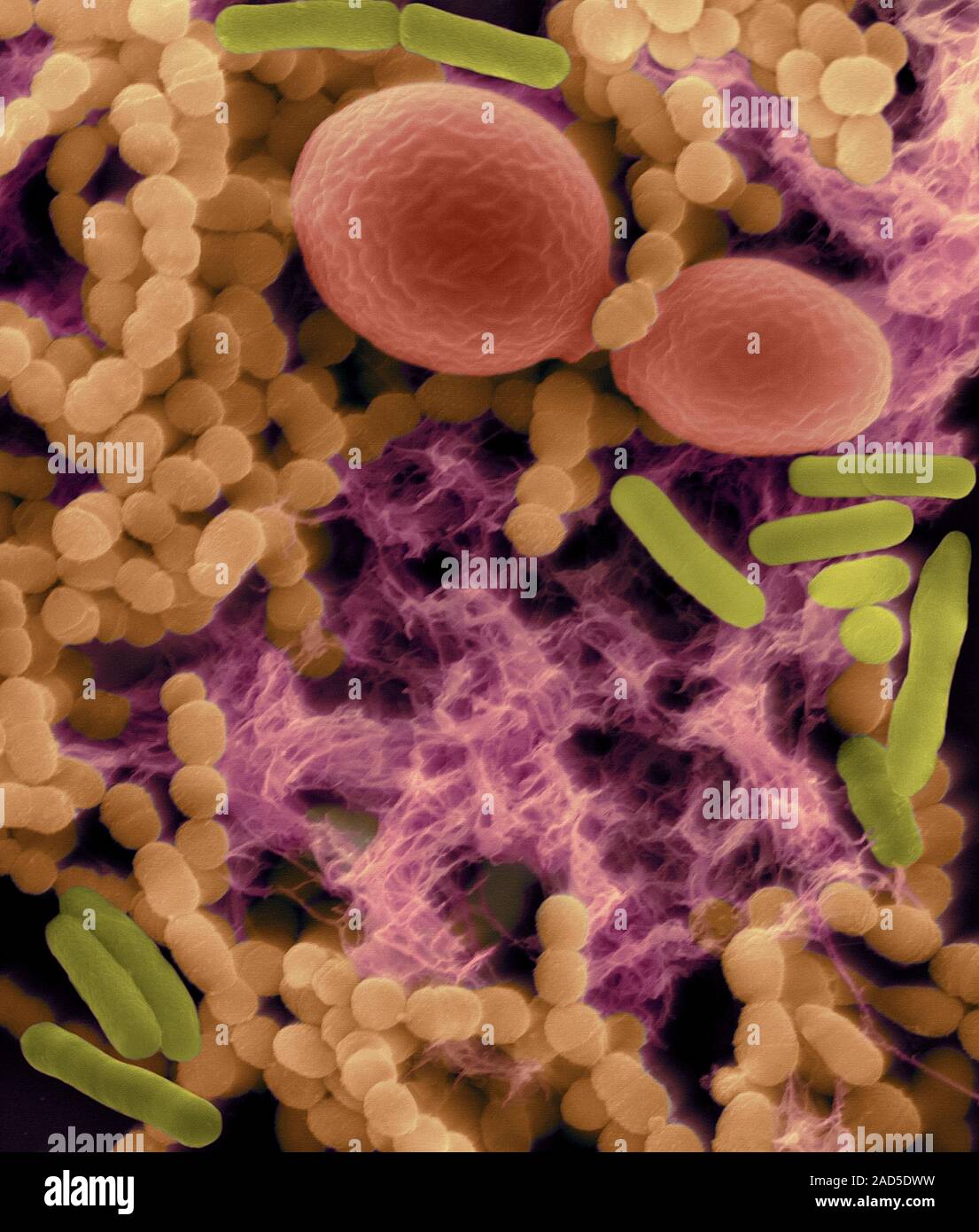 Farbige Scanning Electron Micrograph (SEM) der oralen Mikroben ...