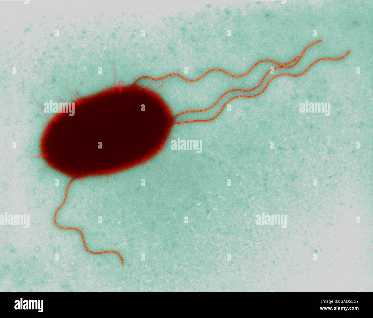 Farbige Transmission Electron Micrograph (TEM) von Escherichia coli ist ...