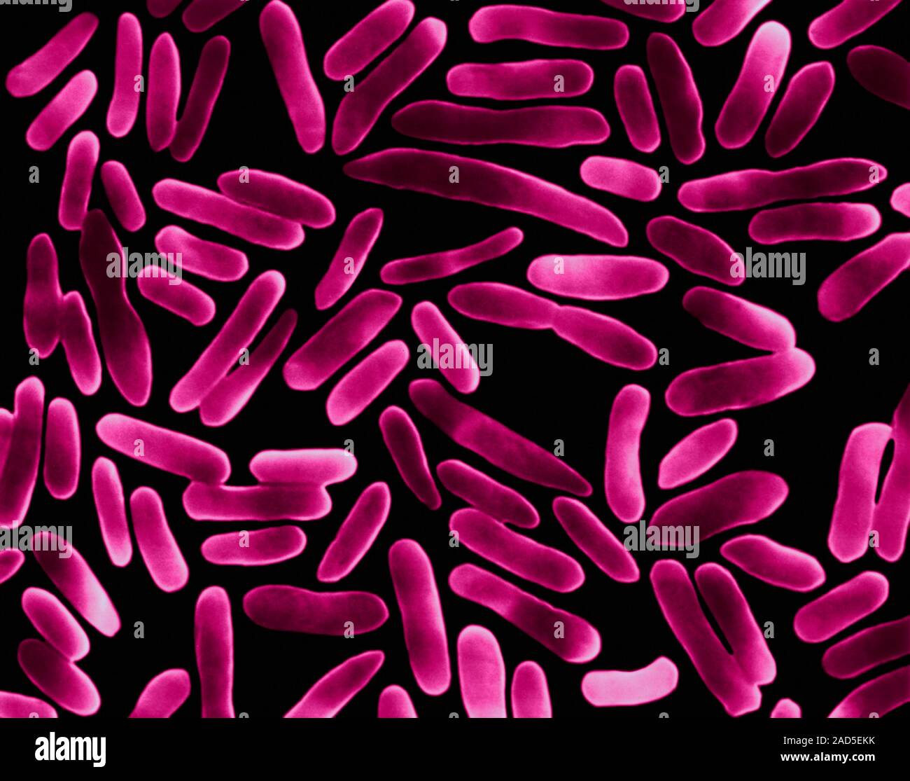 Farbige Scanning Electron Micrograph (SEM) von Escherichia coli ist ein ...