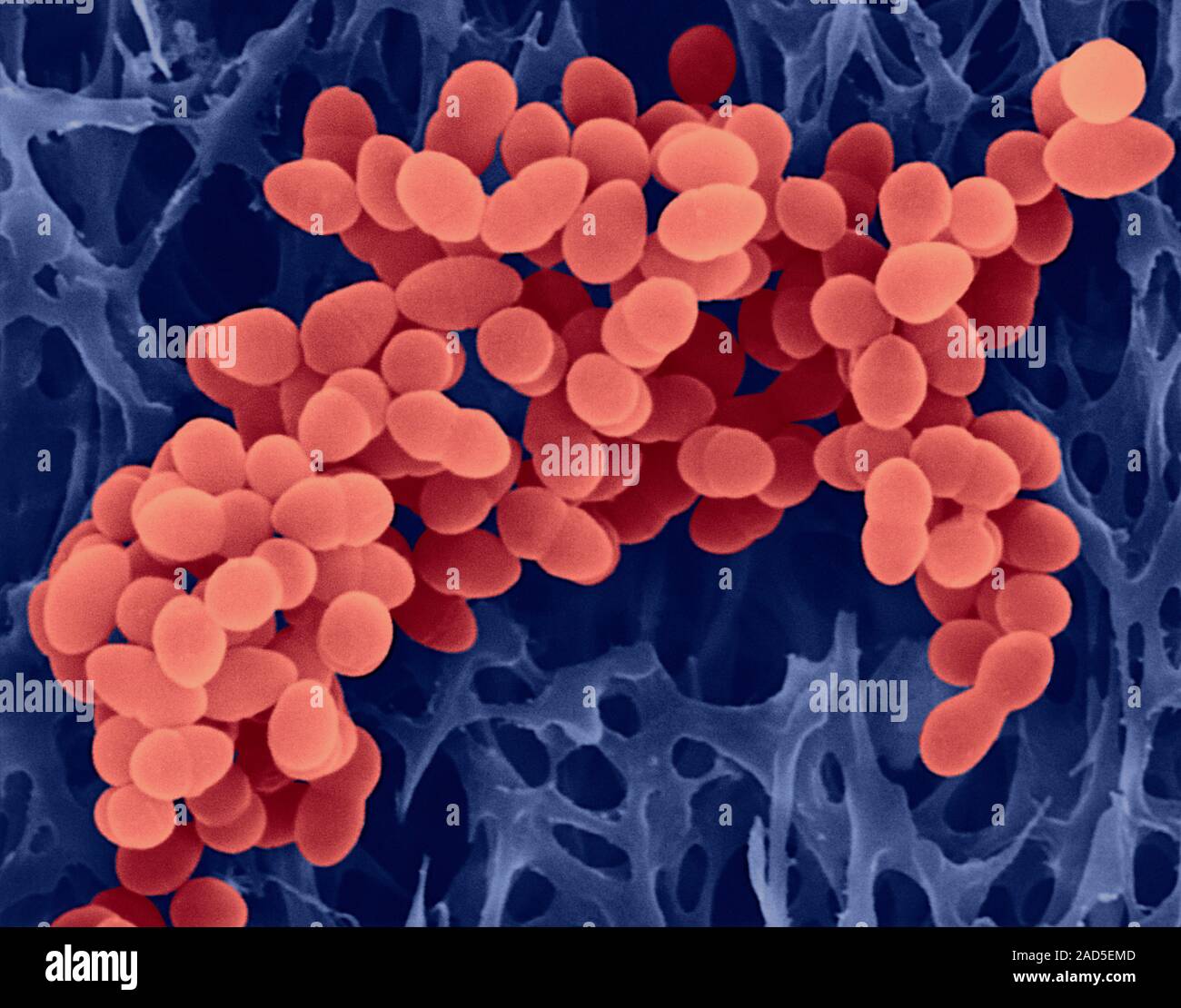 Farbige Scanning Electron Micrograph (SEM) von Staphylococcus aureus, Gram-positive, MRSA ...