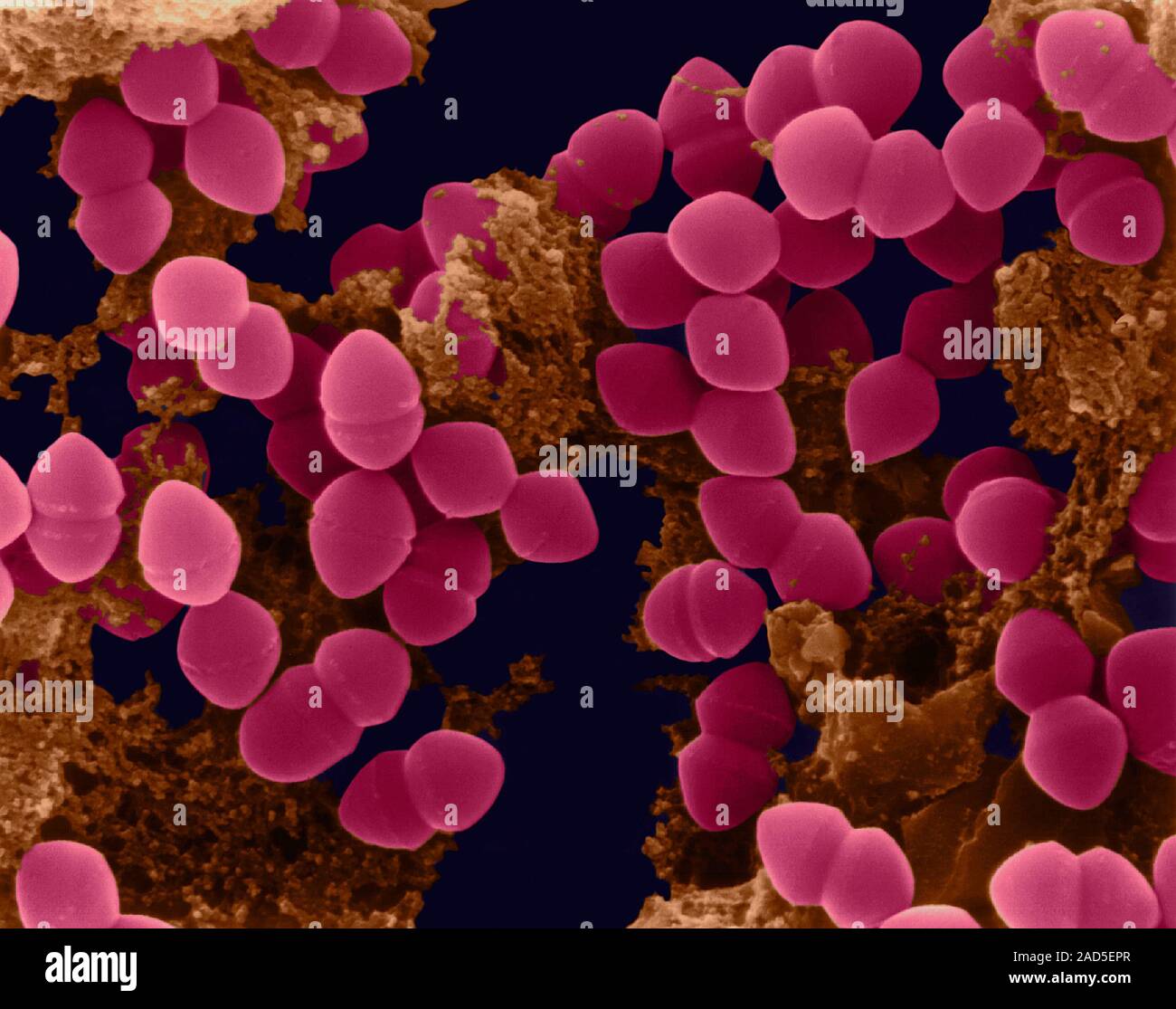 Farbige Scanning Electron Micrograph (SEM) von Enterococcus faecium ...