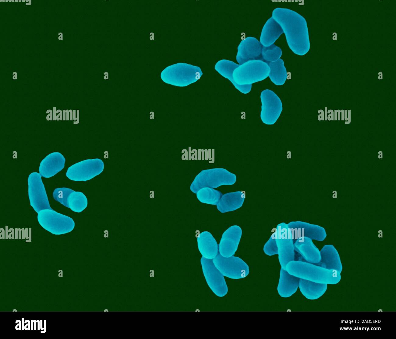 Farbige Scanning Electron Micrograph (SEM) von Francisella tularensis ...