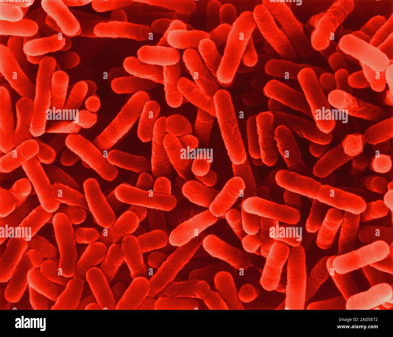 Farbige Scanning Electron Micrograph (SEM) von Legionella pneumophila ...