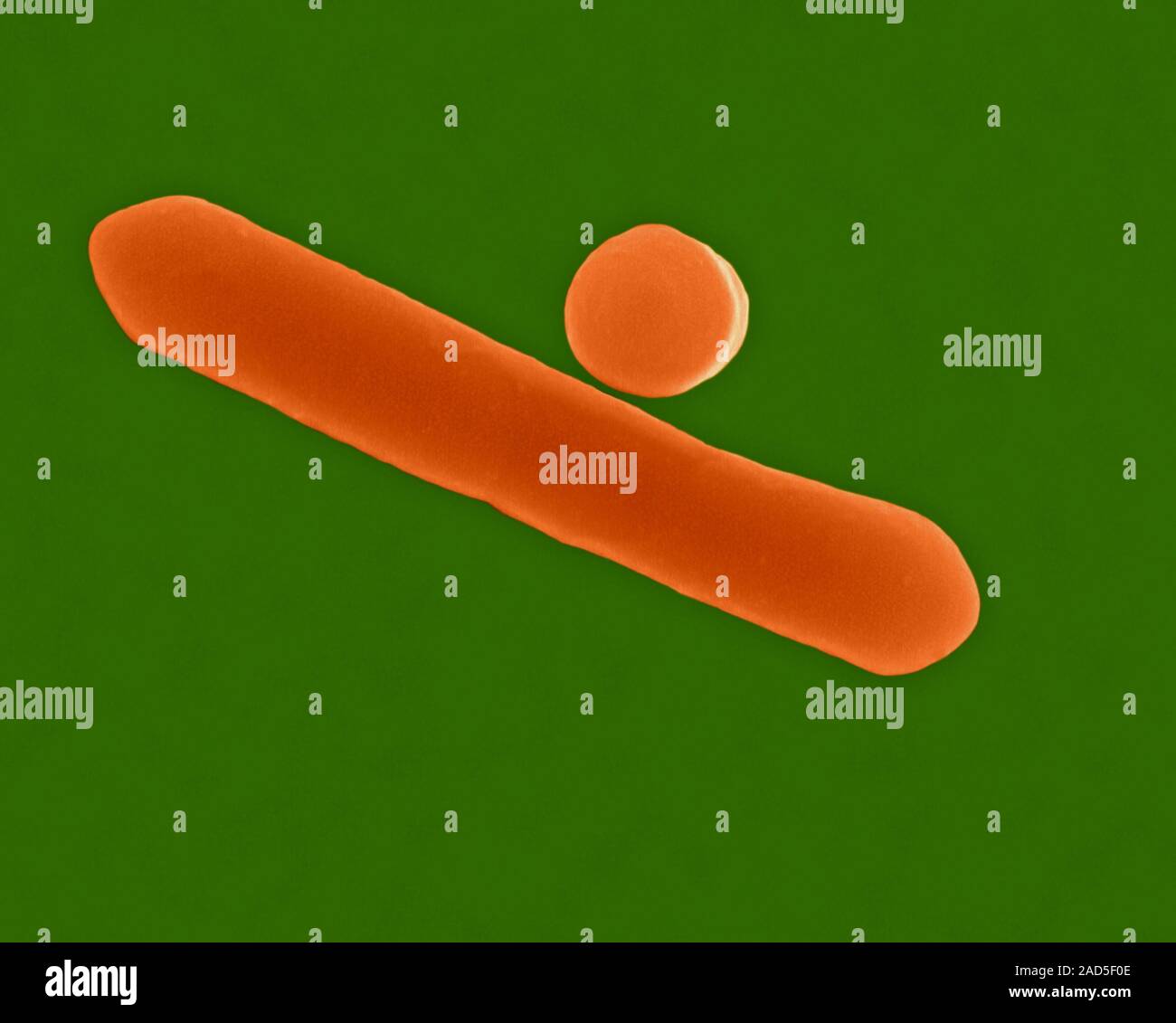 Farbige Scanning Electron Micrograph (SEM) von Clostridium botulinum ...
