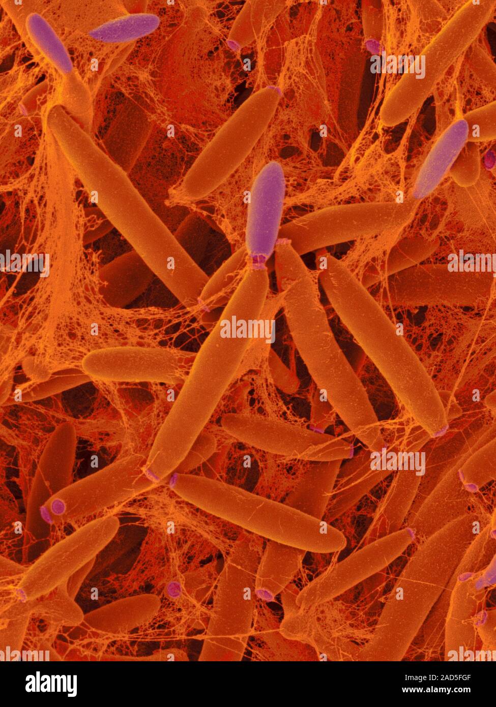 Farbige Scanning Electron Micrograph (SEM) von Ustilago maydis, einer ...