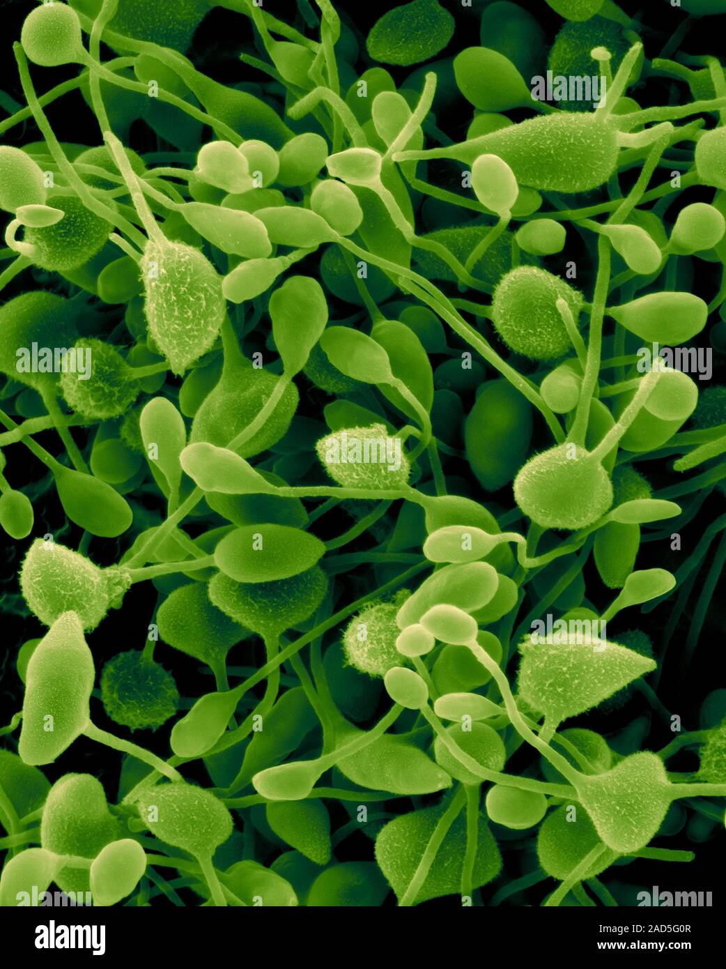 Farbige Scanning Electron Micrograph (SEM) Der basidiomycetous Hefe mit ...