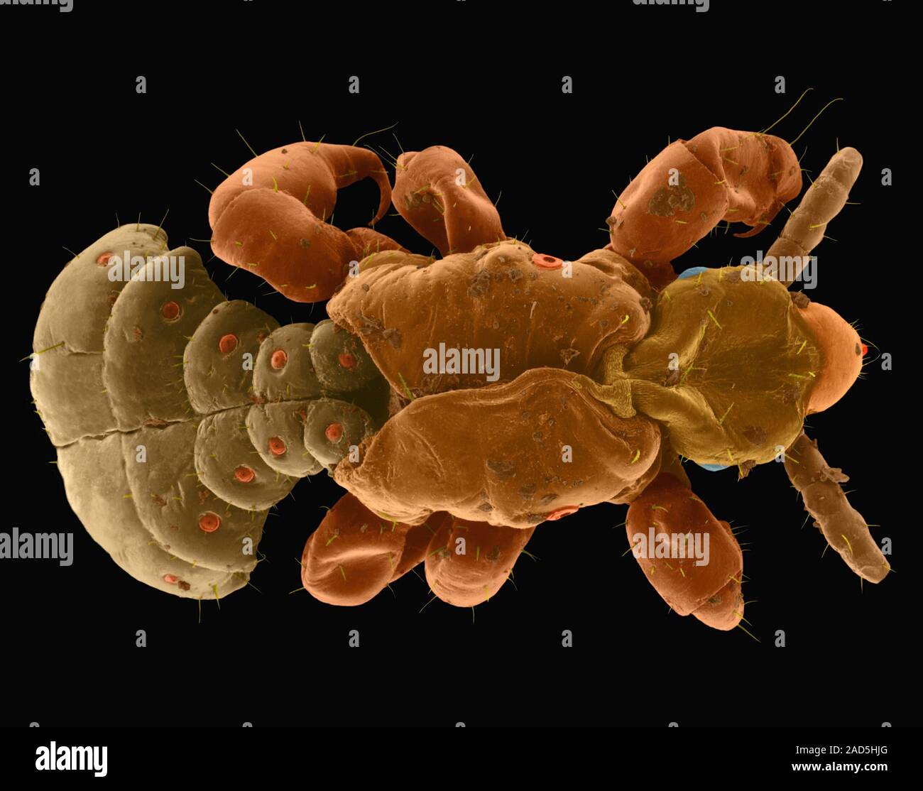 Farbige Scanning Electron Micrograph (SEM) der menschlichen Kopflaus ...