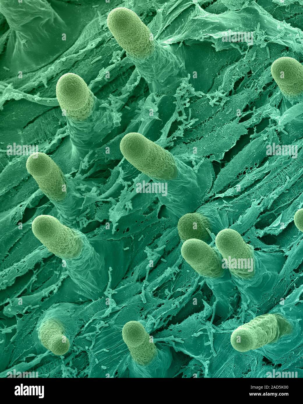Radieschen Keimen (Raphanus sativus), Farbig Scanning Electron ...